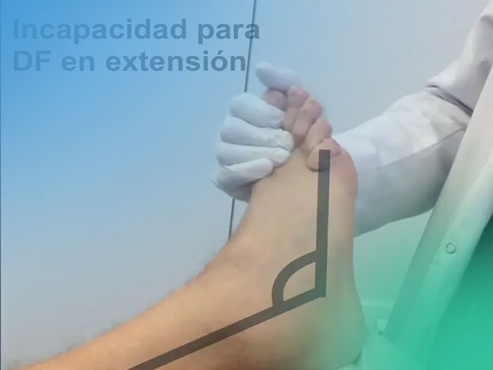 Test de Coleman y Maniobra de Silfverskiöld. Pie Cavo Doloroso - aware ...